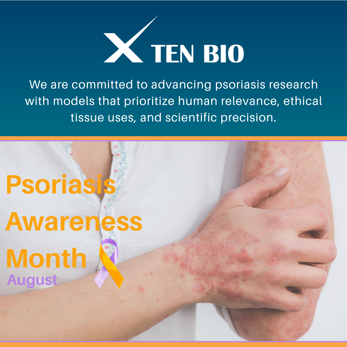 Why psoriasis research needs a human-relevant approach — and how ex ...