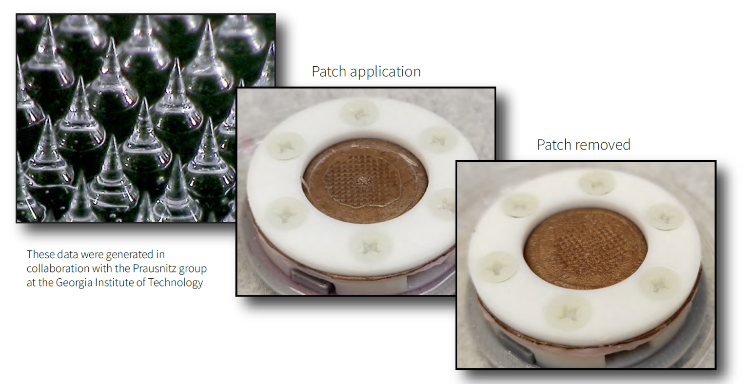 MicroNeedle Injection - Ten Bio