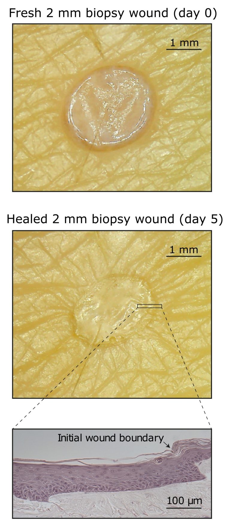 Our differentiation in wound management…. - Ten Bio