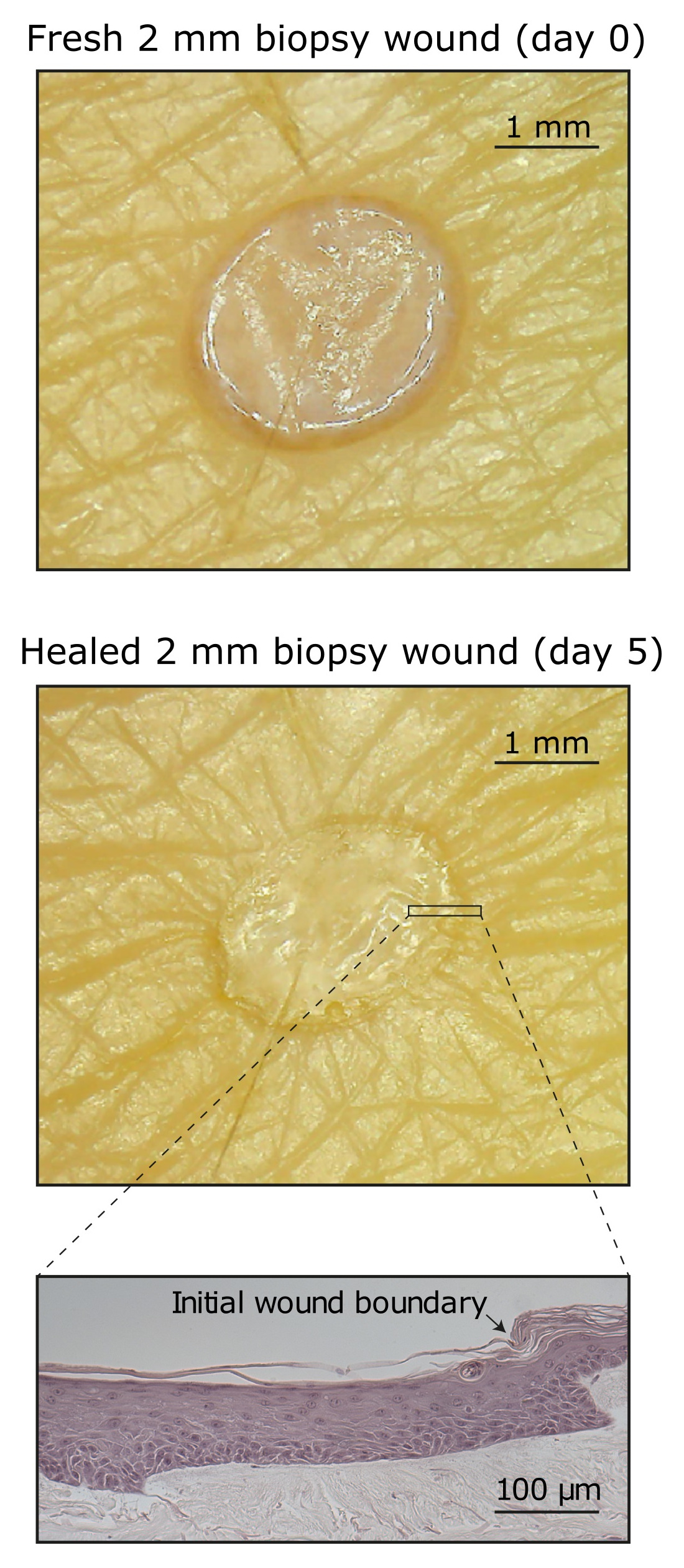 Our differentiation in wound management…. - Ten Bio